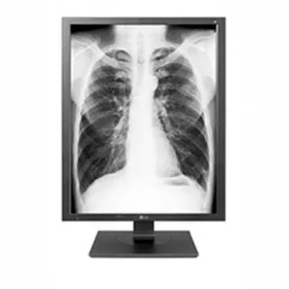 Eizo RX360-DH-NP200 Dual Head 3MP LED Color Diagnostic Display