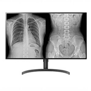 LG 32HL512D 31.5″ 8MP LED Diagnostic Display – 32HL512D-B