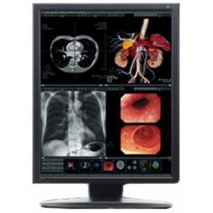 Radiology Displays - Medical Displays for Less