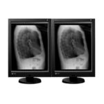 Eizo RadiForce RX660 (RX660-BK) 30″ 6MP Color Diagnostic Monitor ...