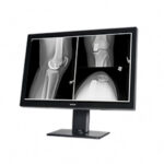 BARCO Monitors - Medical Displays for Less