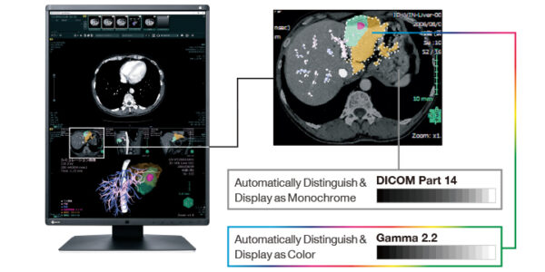 Dual Head 3MP EIZO Radiforce 21.3” Color LCD Diagnostic Display – RX360 ...