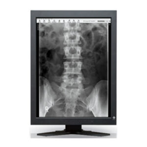 Radiology Displays - Medical Displays for Less