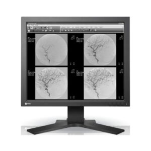 Radiology Displays - Medical Displays for Less