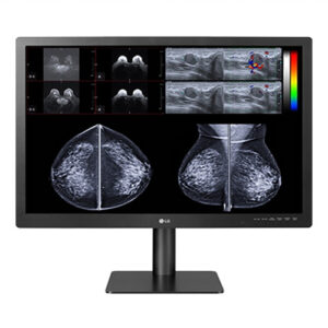 Barco MDMC-32133 Coronis OneLook 33″ Mammography Display